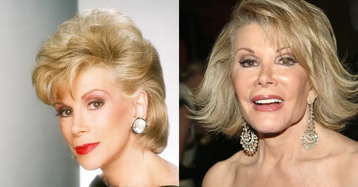 Joan Rivers: A Look Back At Her Cause Of Death