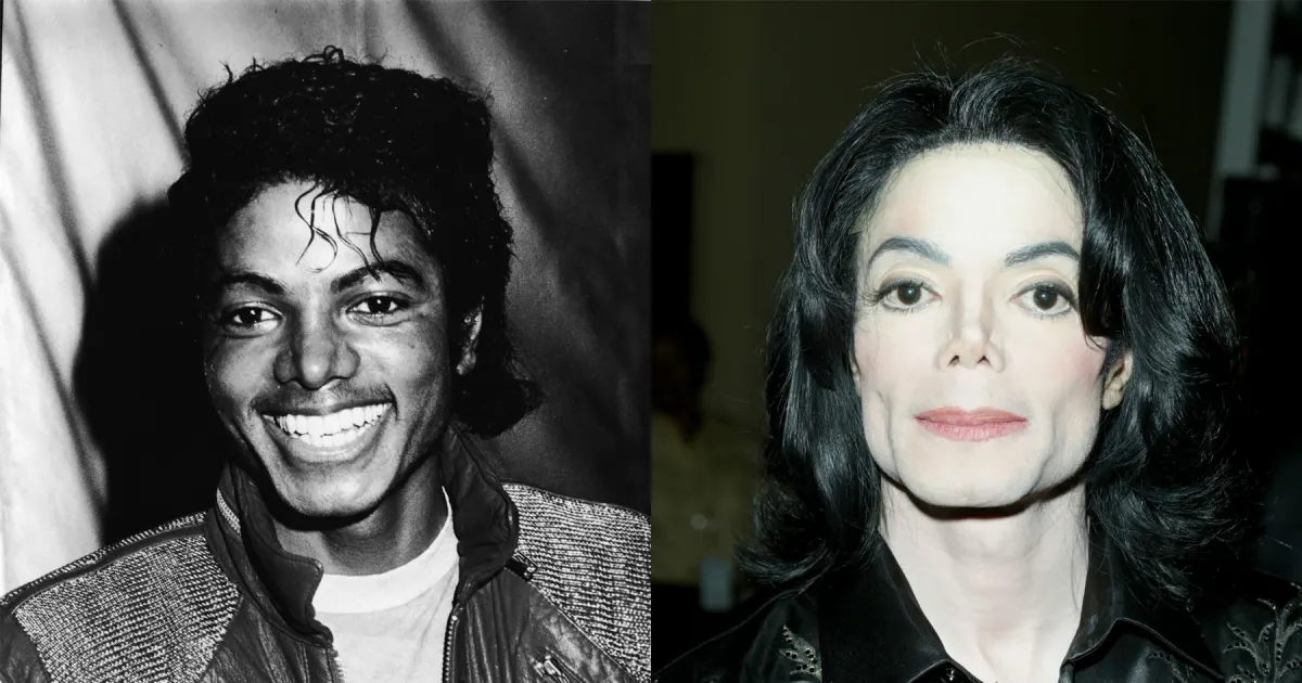 Le Parcours Esthétique Transformateur De Michael Jackson
