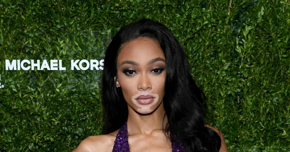 Antm Contestants Where Are They Now Island Outfit Next Top Model Hot
