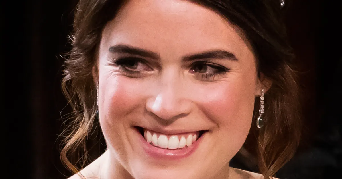 Princess Eugenie Shares Photo Of Her Back Scar