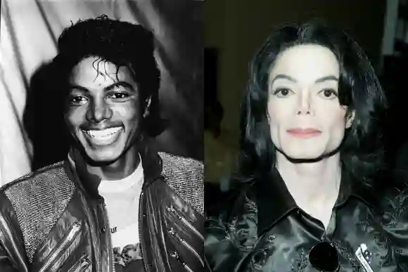 Michael Jackson: All About His Many Cosmetic Surgeries