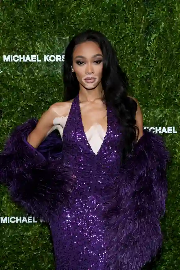 The Queen of Style: Winnie Harlow’s Most Stunning Photos