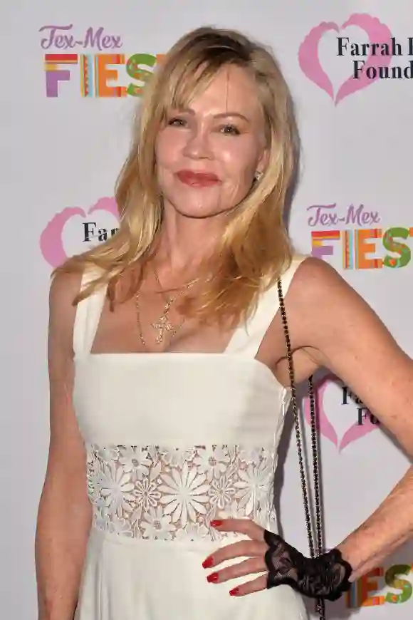 Celebridades antes y después de someterse a una rinoplastia