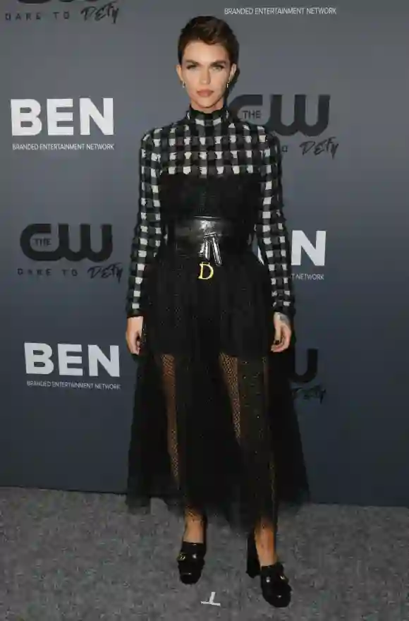 These 14 Actors Were Severely Injured While Filming